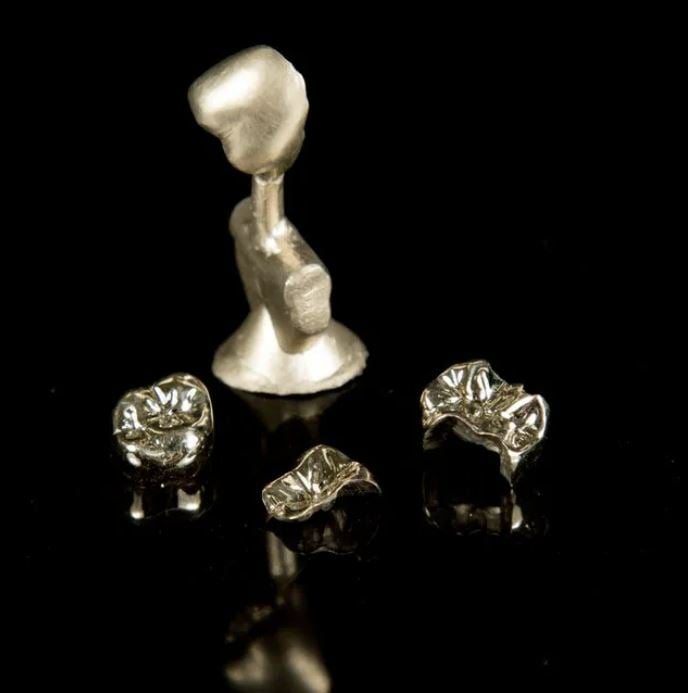 Full Metal Crowns for Dental Restorations | PRO-Craft Dental Lab