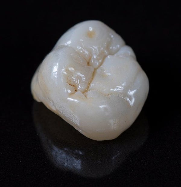 All-Z Solid Zirconia Crowns - High-Strength Full Contour Zirconia | PRO ...