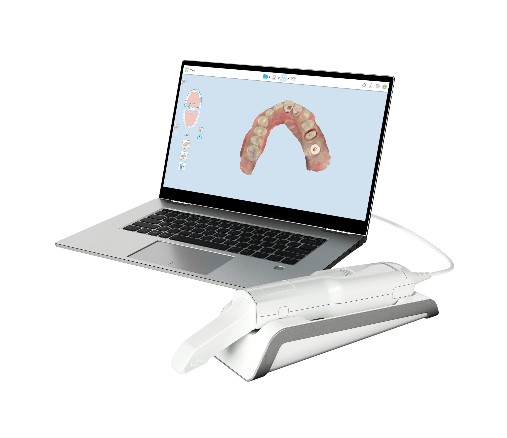 Dental Laboratory Phoenix, AZ | PRO-Craft Dental Laboratory