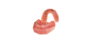 Mini Dental Implant Systems | PRO-Craft Dental Lab